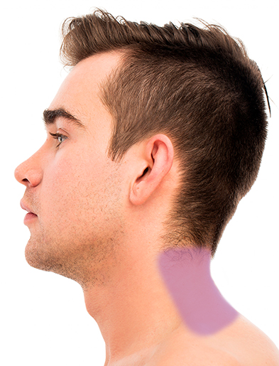 Cuello posterior • Alya Clínica Láser